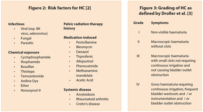 An algorithm for the management of haemorrhagic cystitis | Urology News