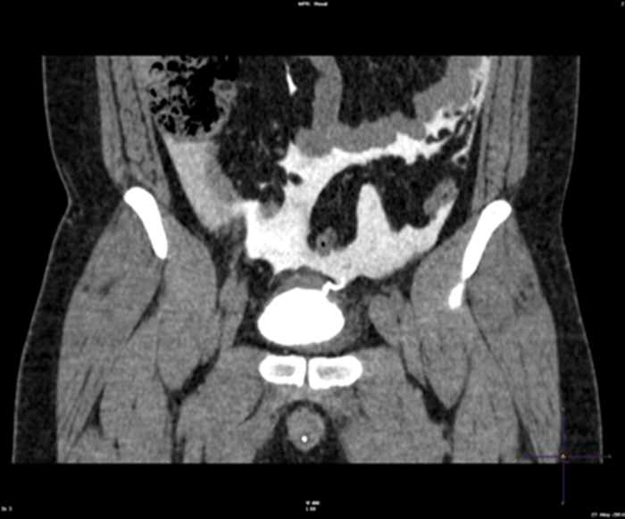 Urological trauma – part 1 | Urology News