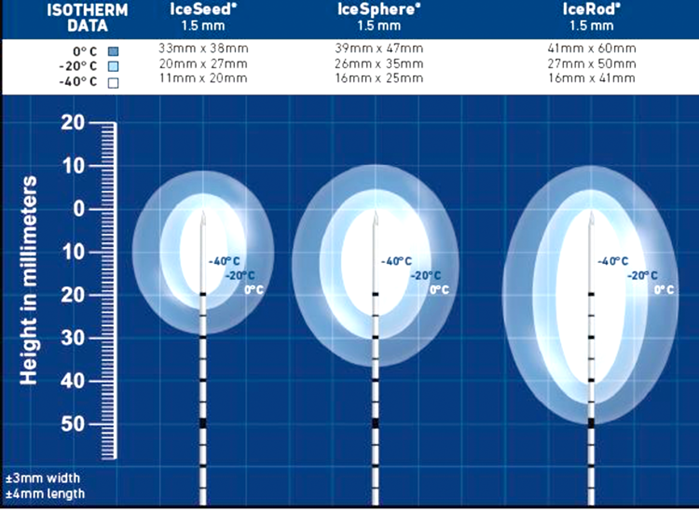 Introduction to prostate cryotherapy | Urology News