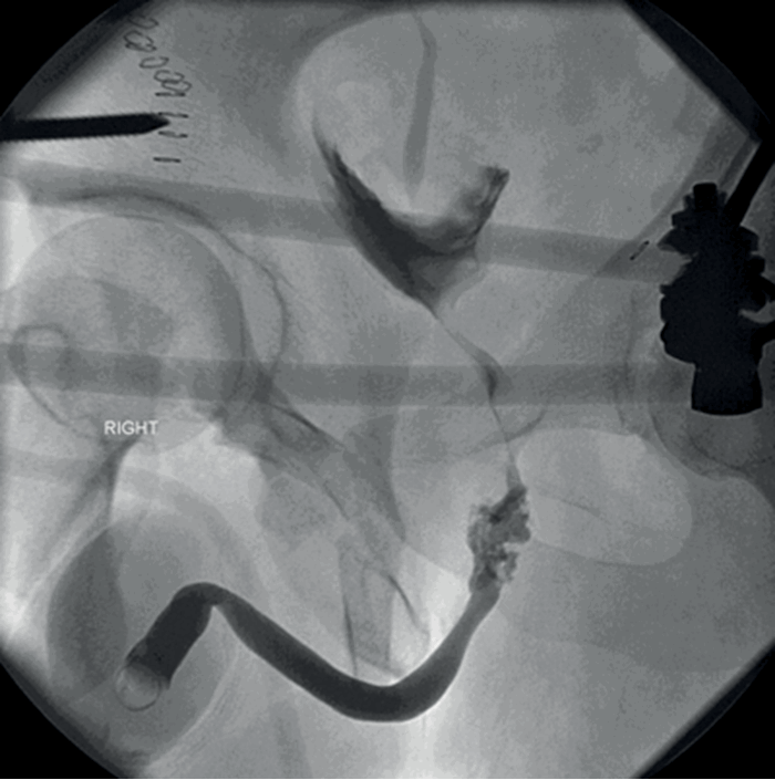 Urological trauma – part 2 | Urology News