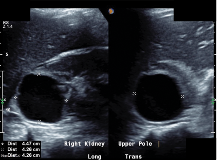 I wasn’t expecting that! A series of unexpected radiology findings ...