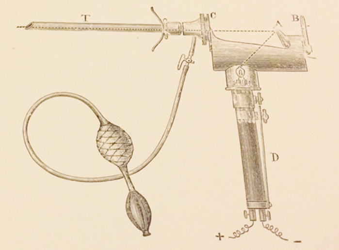 The aero-urethroscope | Urology News