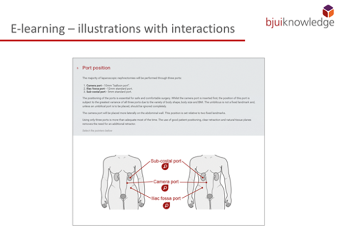 Making the most of BJUI Knowledge – a trainee’s perspective | Urology News
